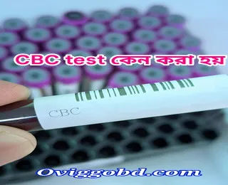Cbc Test কি?cbc Test এর দাম কত? Cbc Test কেন করা হয়? Cbc Test এর সকল ...