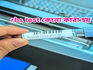 Rbs Test কি এবং কেন করা হয়? Rbs টেস্ট নরমাল কত ? Rbs বেড়ে গেলে কি হয় ...