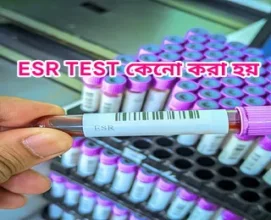 Esr Test কি ও কেনো করা হয়? রক্তে Esr বাড়লে কি হয়? Esr কমানোর উপায় ...