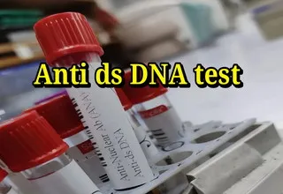 Anti Ds Dna Test কি এবং কেন করা হয়? নরমাল কত, খরচ কত? || Anti Ds Dna ...