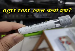 Ogtt Test কেন করা হয়? Ogtt Test করার উপযুক্ত সময় কোনটি? রিপোর্ট ...