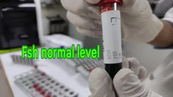 Fsh Test নরমাল কত? FSH হরমোন বেড়ে গেলে কি হয়? FSH কমে গেলে কি হয় ...