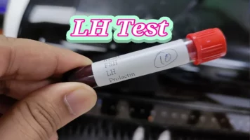 Lh Test কি এবং কেন করা হয়? খরচ কত ,স্যাম্পল কালেকশন,প্রিপারেশন ...