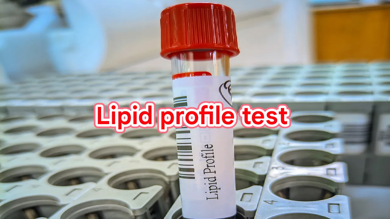 Lipid Profile Test কি এবং কেন করা হয়? দাম কত ,নরমাল কত?- Lipid Profile ...