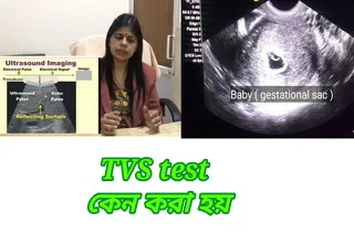 টিভিএস টেস্ট কি এবং কেন করা হয়? খরচ কত, প্রিপারেশন, ডেলিভারি সময় সব কিছু এক পোস্টে। || Tvs ...