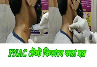 FNAC Test কি এবং কেন করা হয়? খরচ কত, প্রিপারেশন, রিপোর্ট ডেলিভারি সময় ...