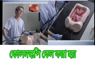 কোলনস্কপি কি এবং কেন করা হয়? প্রিপারেশন,টেস্ট খরচ,রিপোর্ট ডেলিভারি সময় জেনে নিন। | Colonoscopy ...
