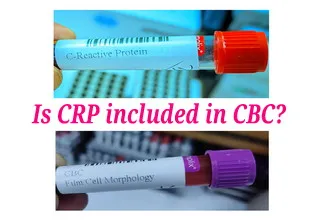 Is CRP Included In CBC Or Is Crp Tested In CBC: Everything You Need To ...