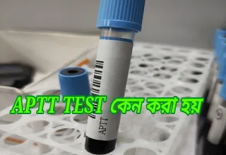 APTT TEST কি এবং কেন করা হয়? APTT TEST এর সকল কিছু জেনে নিন ...