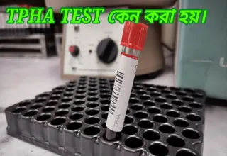 Tpha Test কি এবং কেন করা হয় ? Tpha টেস্ট সম্পর্কে সকল কিছু জেনে নিন ...